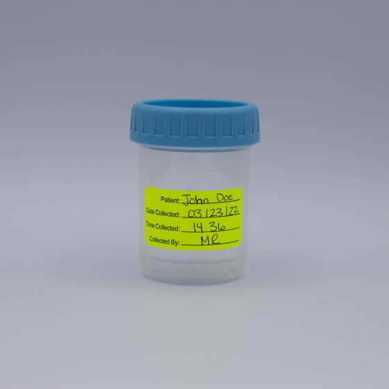 Patient Specimen Collection Labels - InStockLabels.com