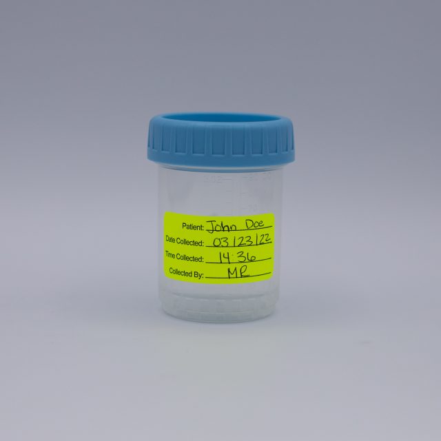 Patient Specimen Collection Labels - InStockLabels.com